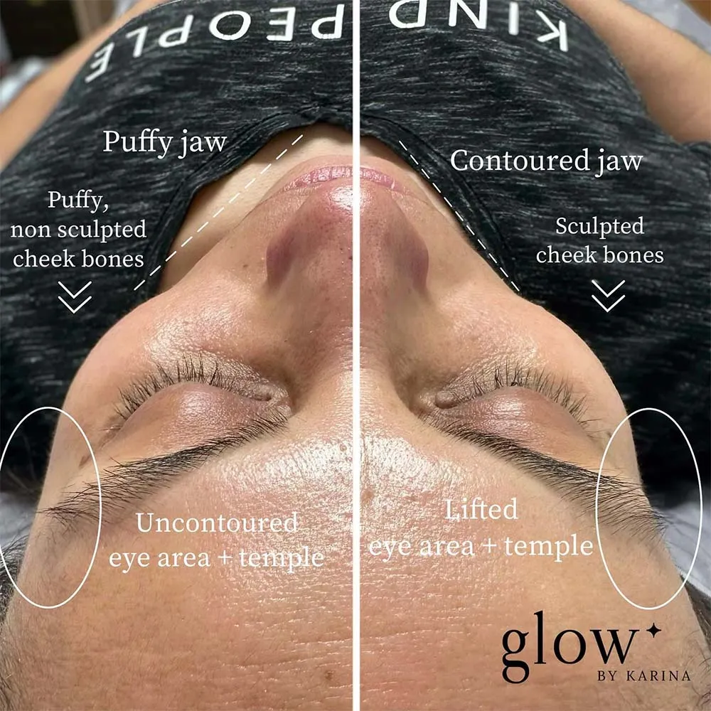 Microcurrent Facial - All You Need to Know Microcurrent Facial - All You Need to Know