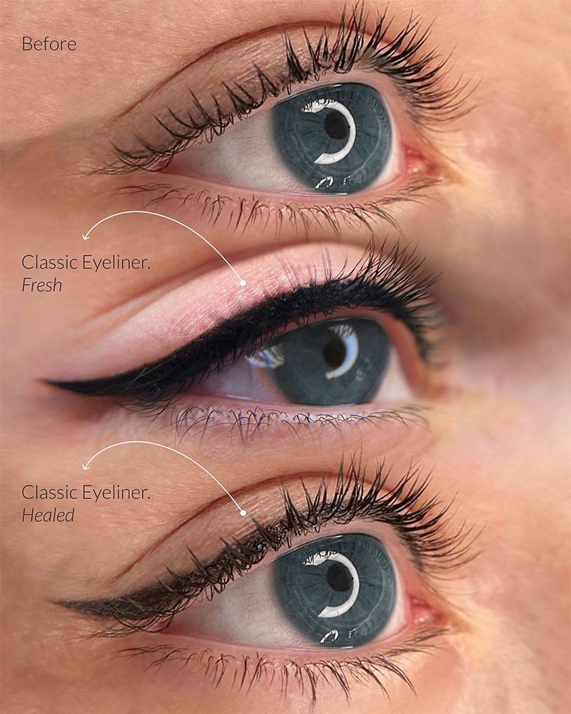 Permanent Eyeliner Healing Process 2024 Day by Day Overview